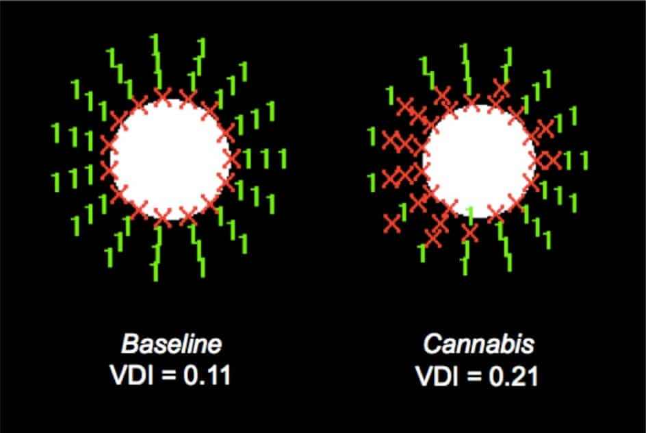 Marijuana's Effects on Vision and Visual Perceptions